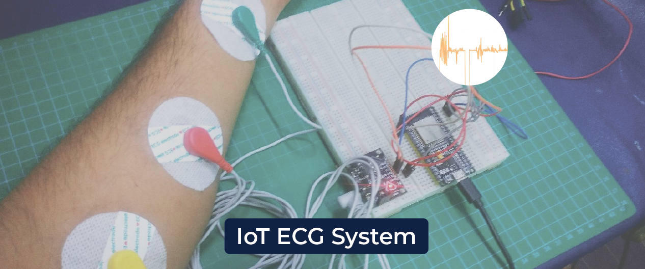 Iot Based Ecg Monitoring With Ad8232 Ecg Sensor Amp Esp32 - Bank2home.com Iot Based Ecg Monitoring With Ad8232 Ecg Sensor Amp Esp32 - Bank2home.com